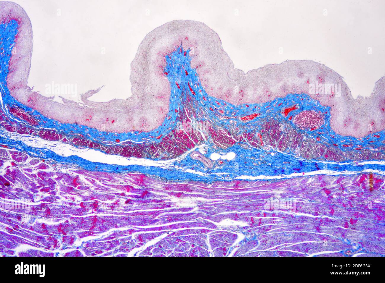Stratified squamous epithelium hi-res stock photography and images - Alamy