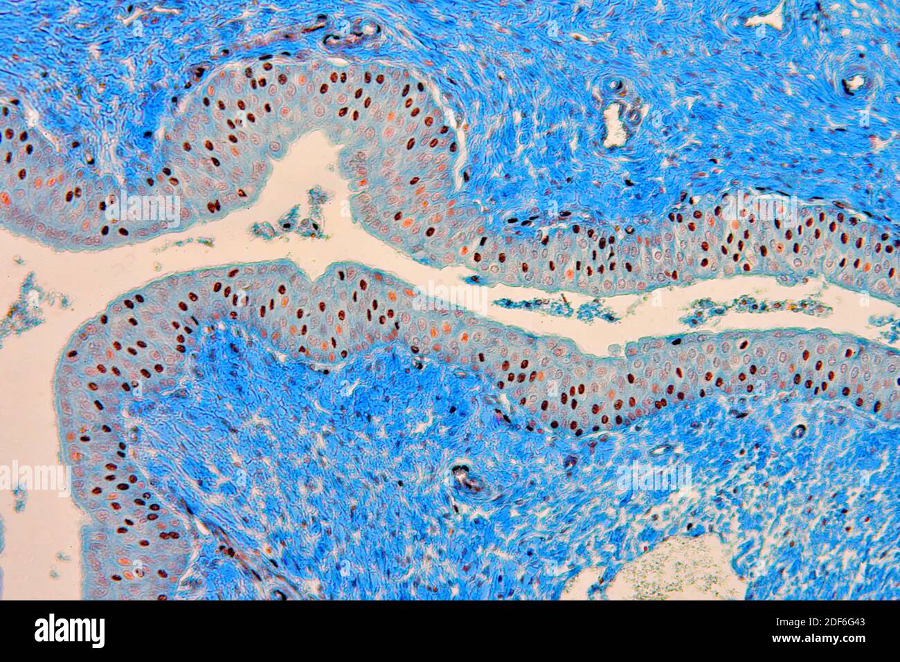 Urethra epithelium hi-res stock photography and images - Alamy