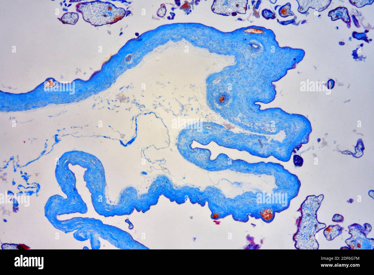 Female Reproductive Organ High Resolution Stock Photography and Images ...