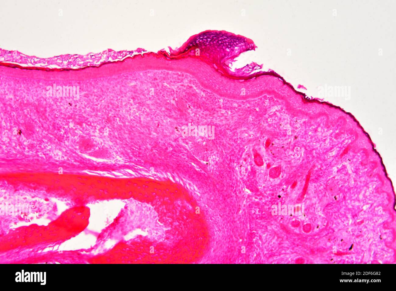 Dermis and epidermis hi-res stock photography and images - Alamy