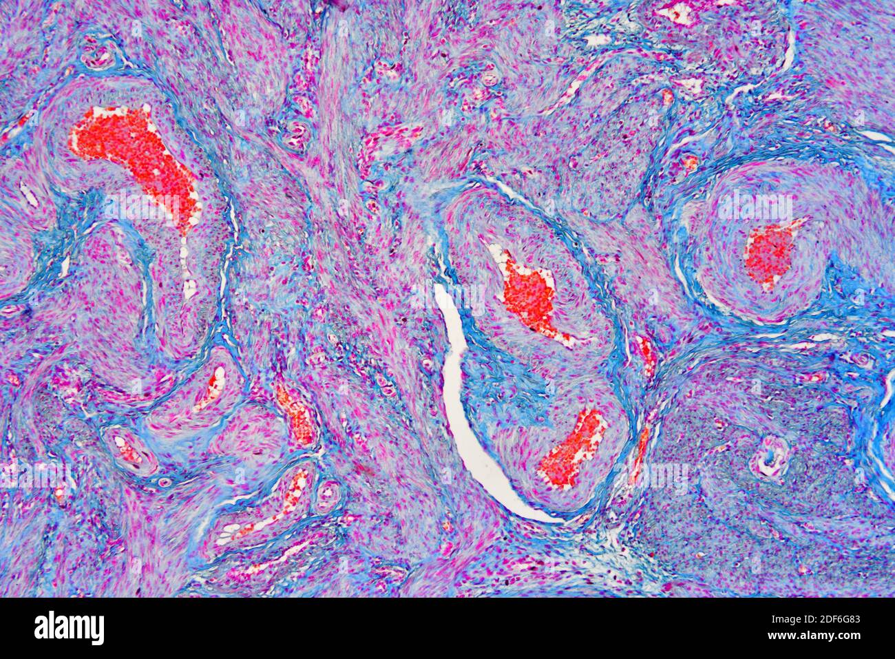 Uterus hi-res stock photography and images - Alamy