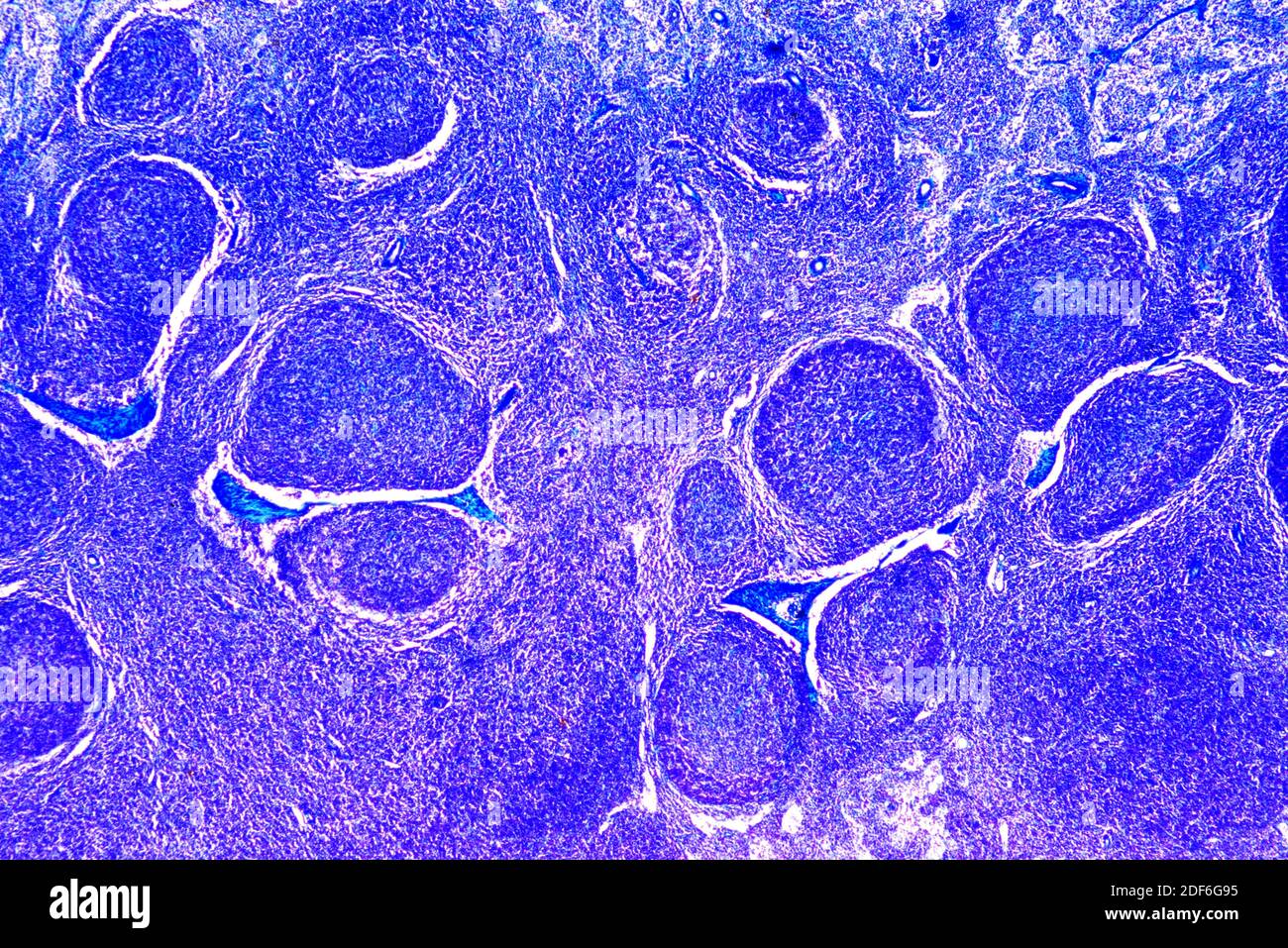 Lymphatic system human hi-res stock photography and images - Alamy