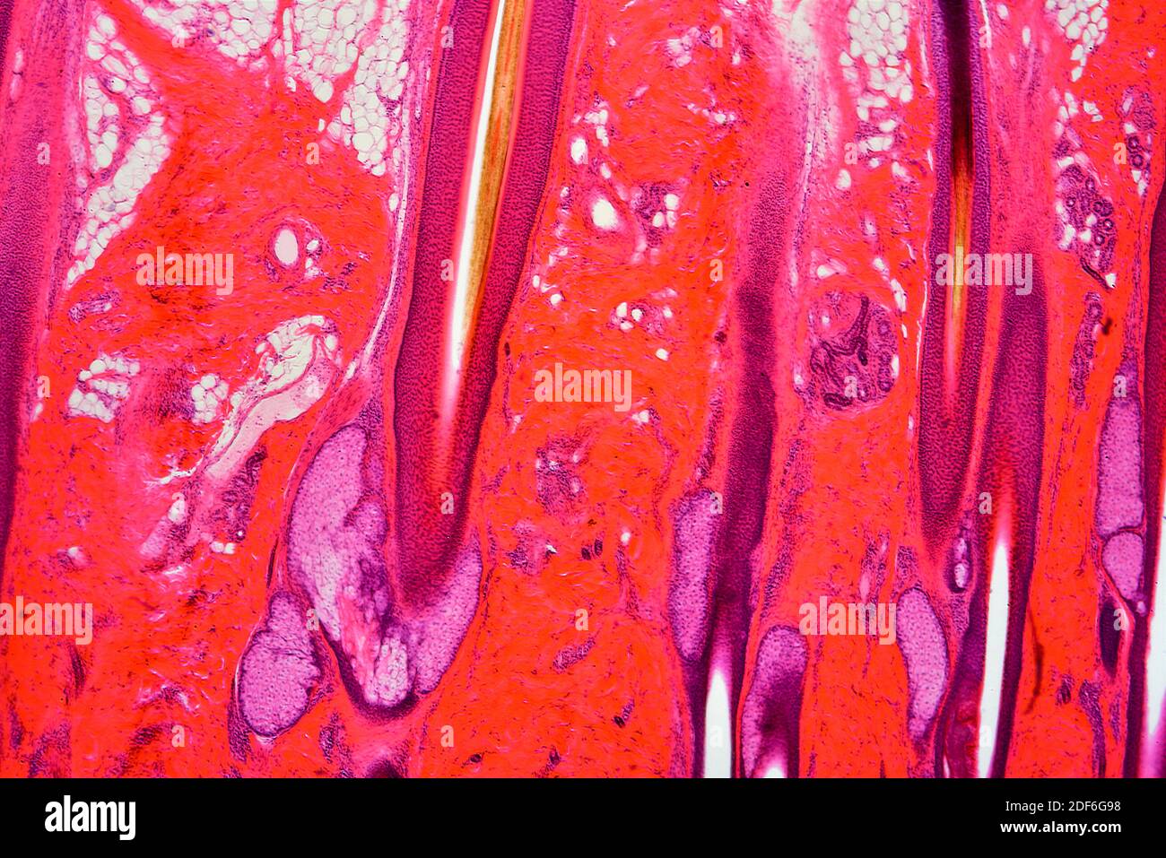 Human Scalp Under Microscope Labeled
