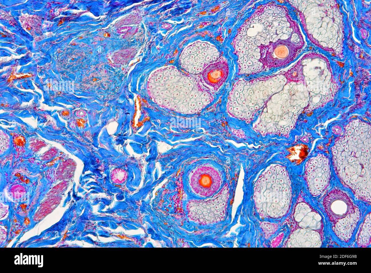 Sebaceous Gland High Resolution Stock Photography and Images - Alamy