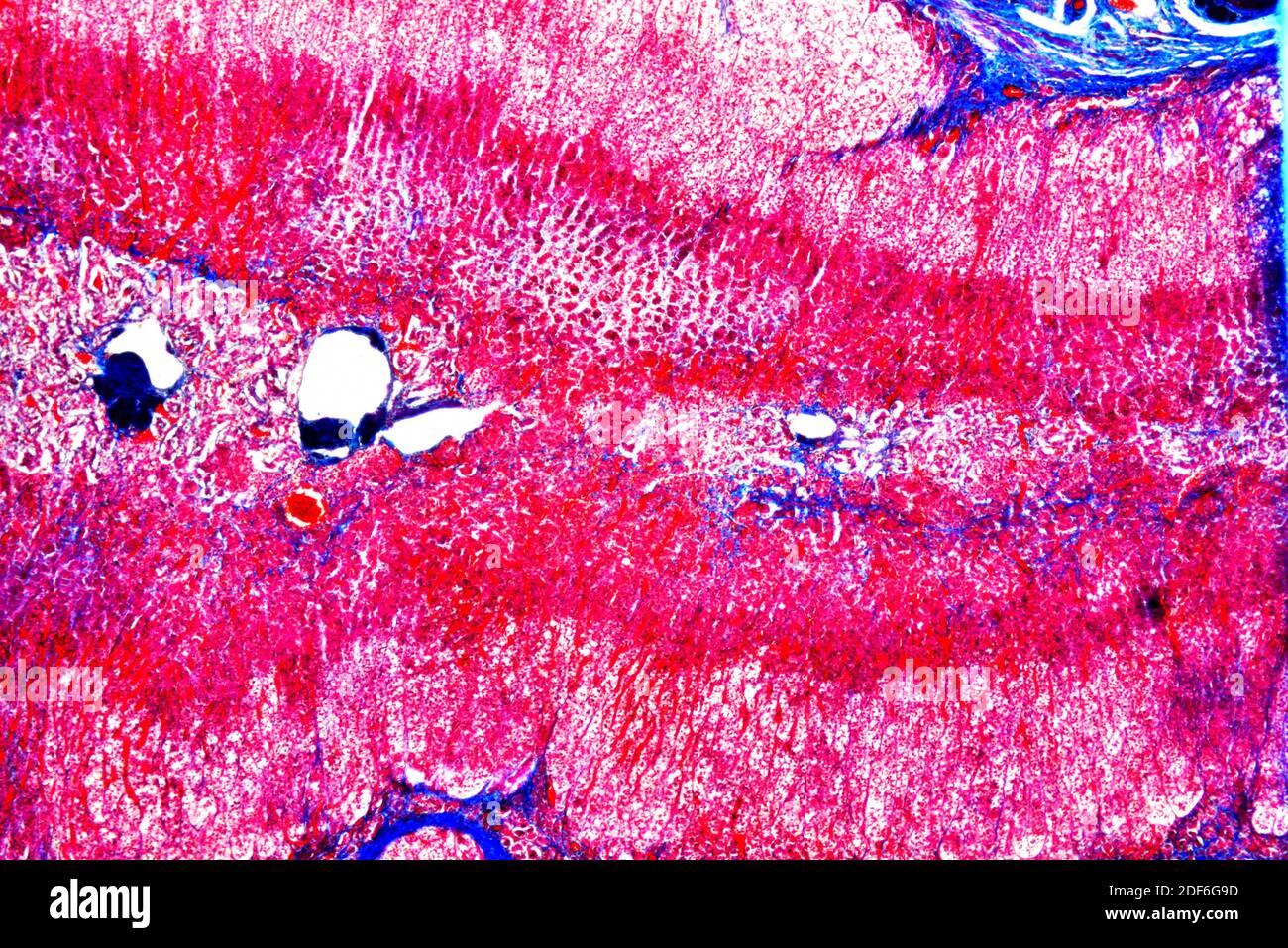 Zona Reticularis High Resolution Stock Photography and Images - Alamy