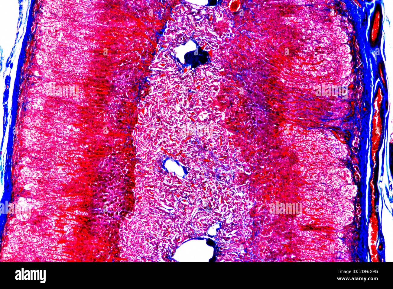 Human Adrenal Gland Histology