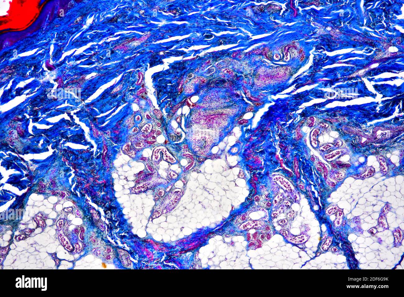 Connective tissue with collagen fibers hi-res stock photography and ...