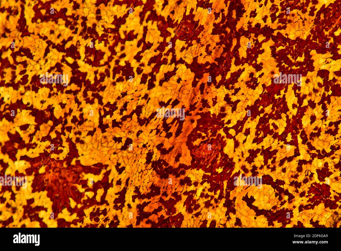 Squamous Epithelium Micrograph High Resolution Stock Photography and ...