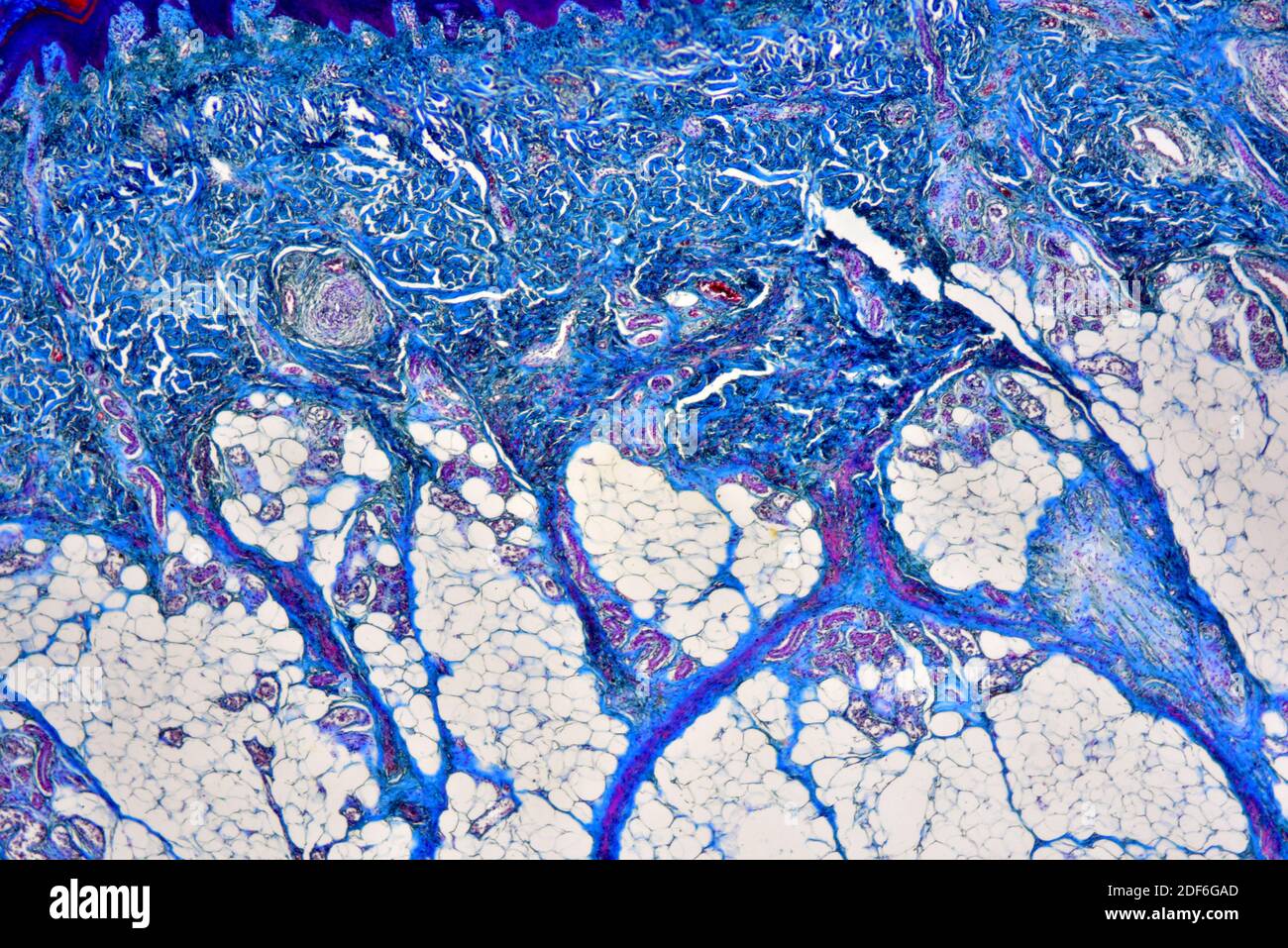 Collagen Fibre High Resolution Stock Photography and Images - Alamy