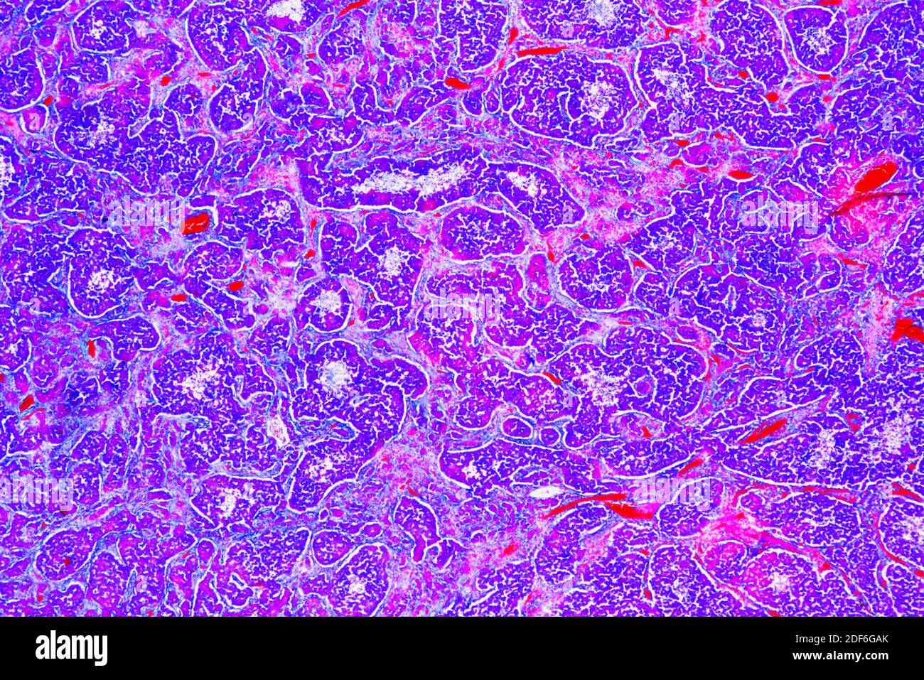 Pituitary gland micrograph hi-res stock photography and images - Alamy