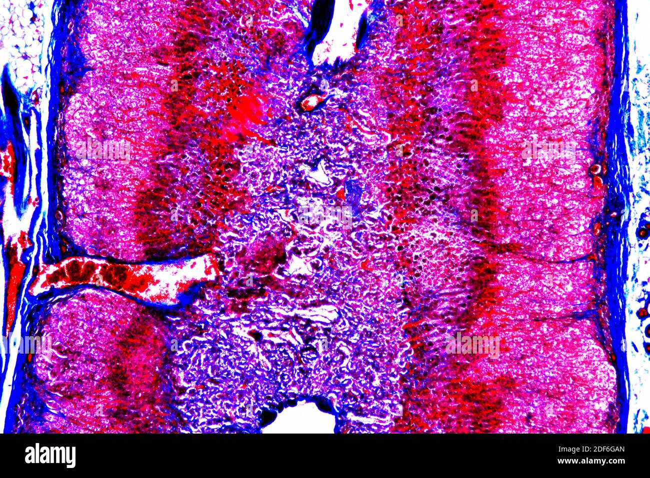 Adrenal gland microscope hi-res stock photography and images - Alamy