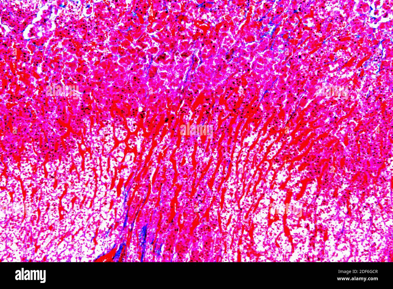 Adrenal gland microscope hi-res stock photography and images - Alamy