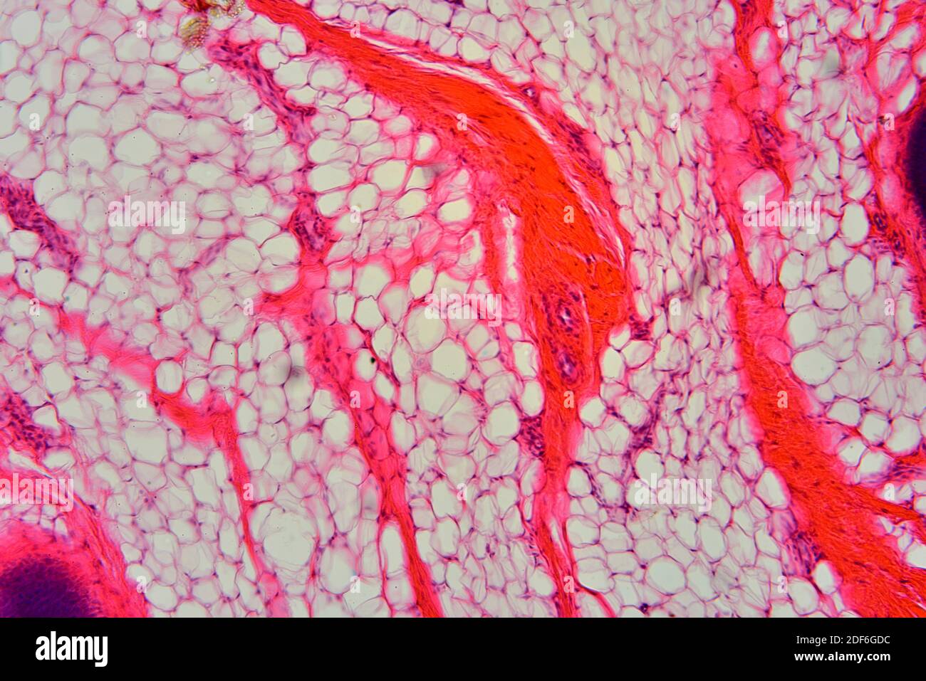 Adipose tissue from skin. Optical microscope X100 Stock Photo - Alamy