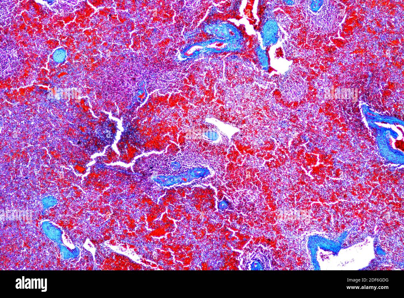 The normal hi-res stock photography and images - Alamy