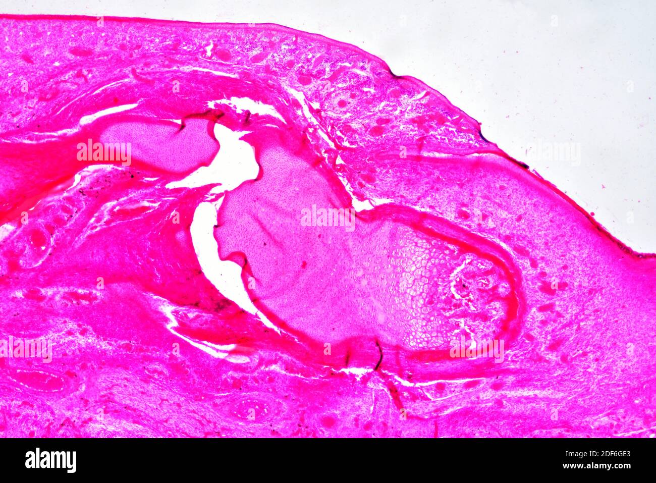 Hyponychium Histology