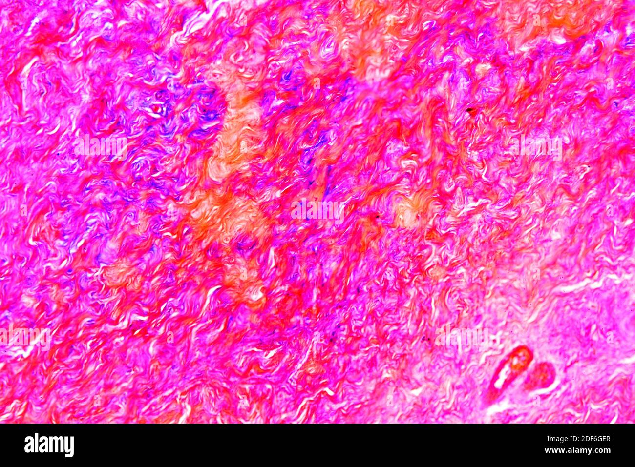 Fibrocartilage tissue showing collagen fibers. Optical microscope X100 ...