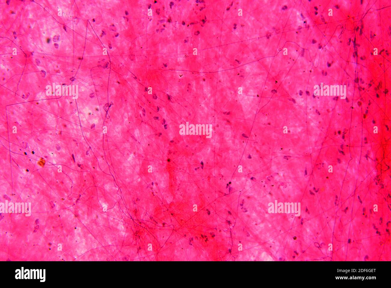 Reticular Tissue