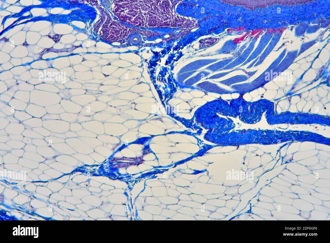Tissue body hi-res stock photography and images - Alamy