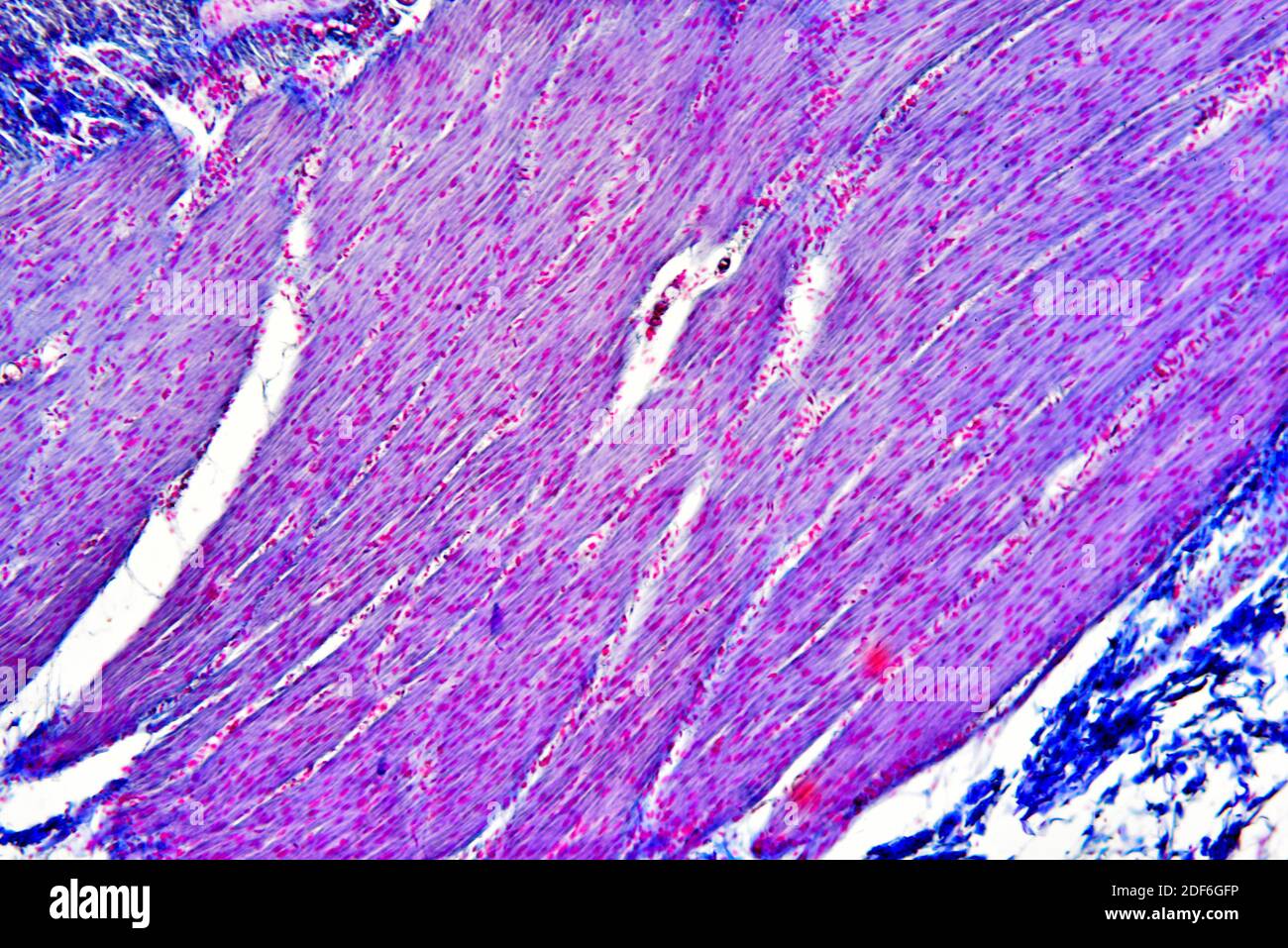 Smooth Muscle Micrograph High Resolution Stock Photography and Images ...