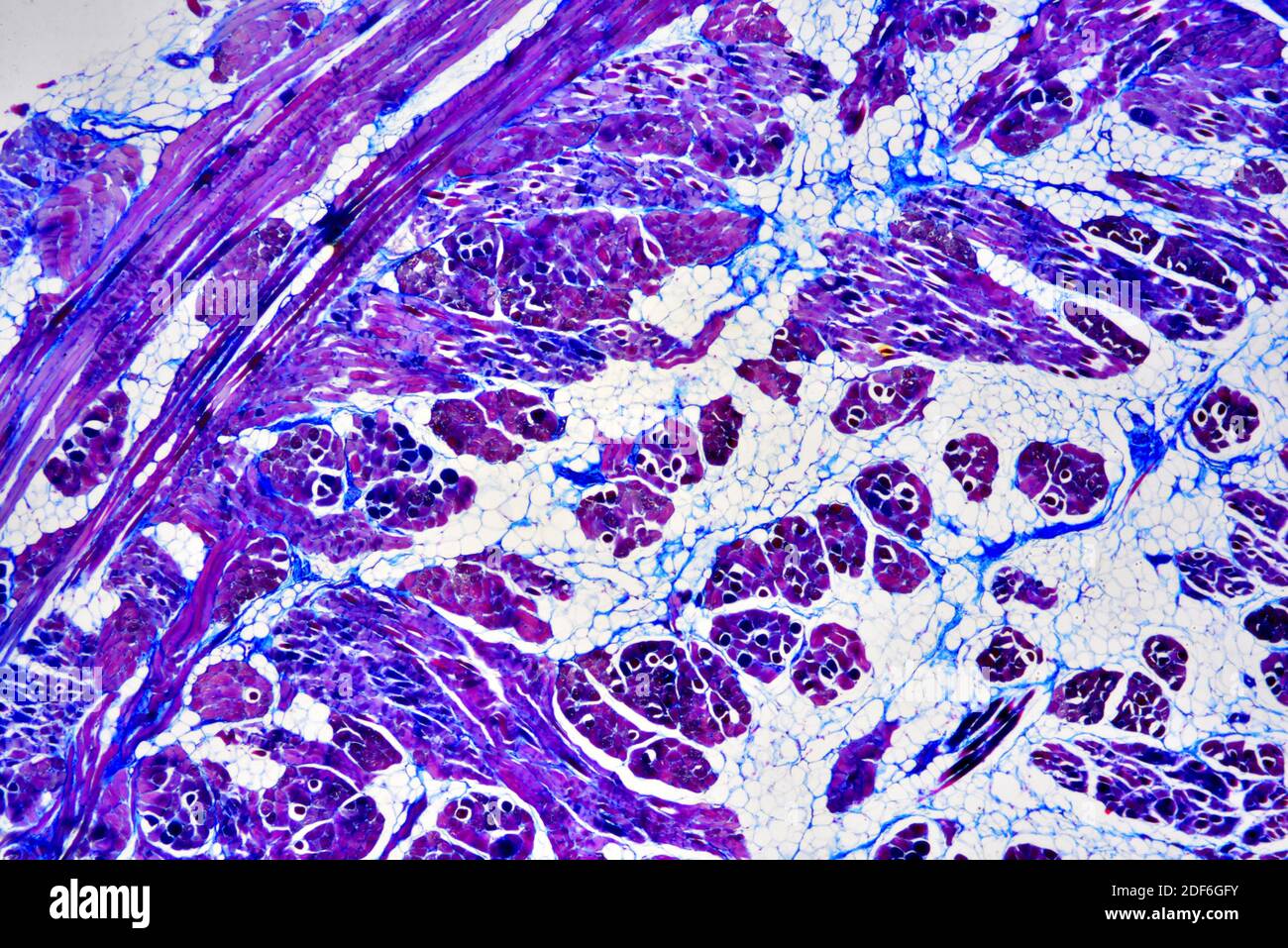 Skeletal Muscle Tissue Longitudinal Section High Resolution Stock ...