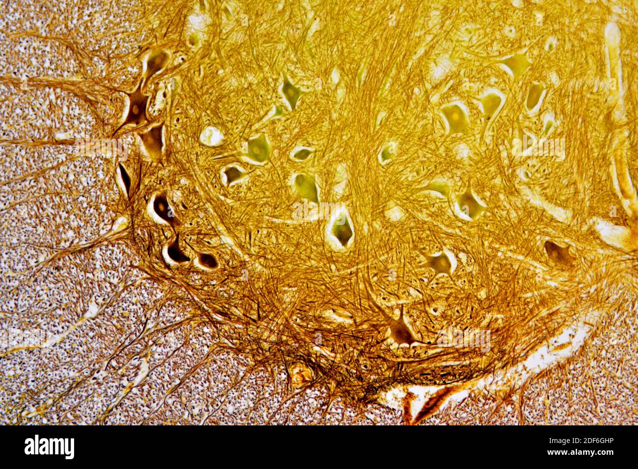 Photomicrograph neuron hi-res stock photography and images - Alamy