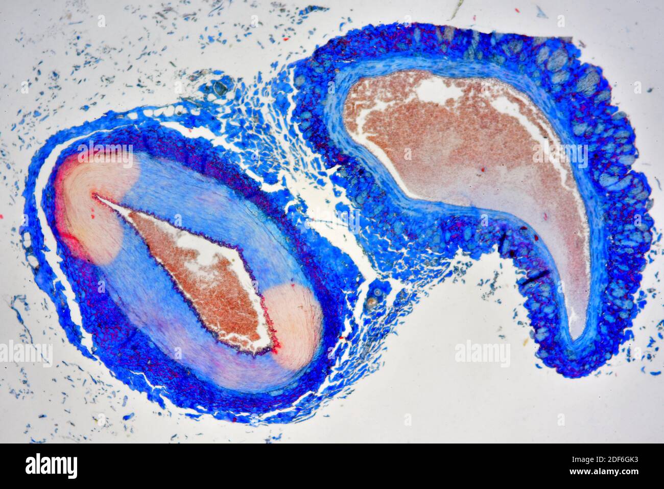 Blood Vessels Micrograph High Resolution Stock Photography and Images ...