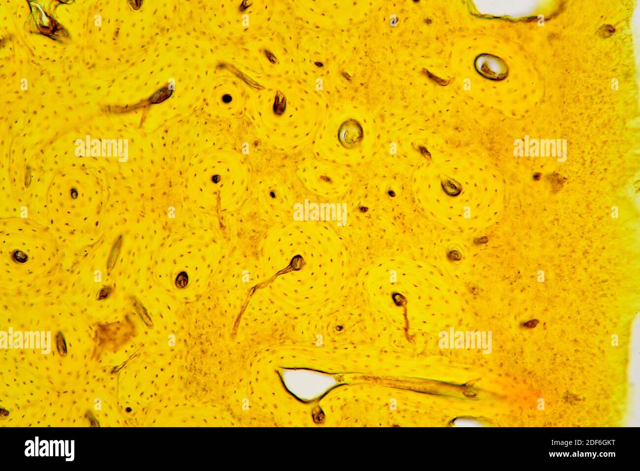 Micrograph osseous tissue hi-res stock photography and images - Alamy