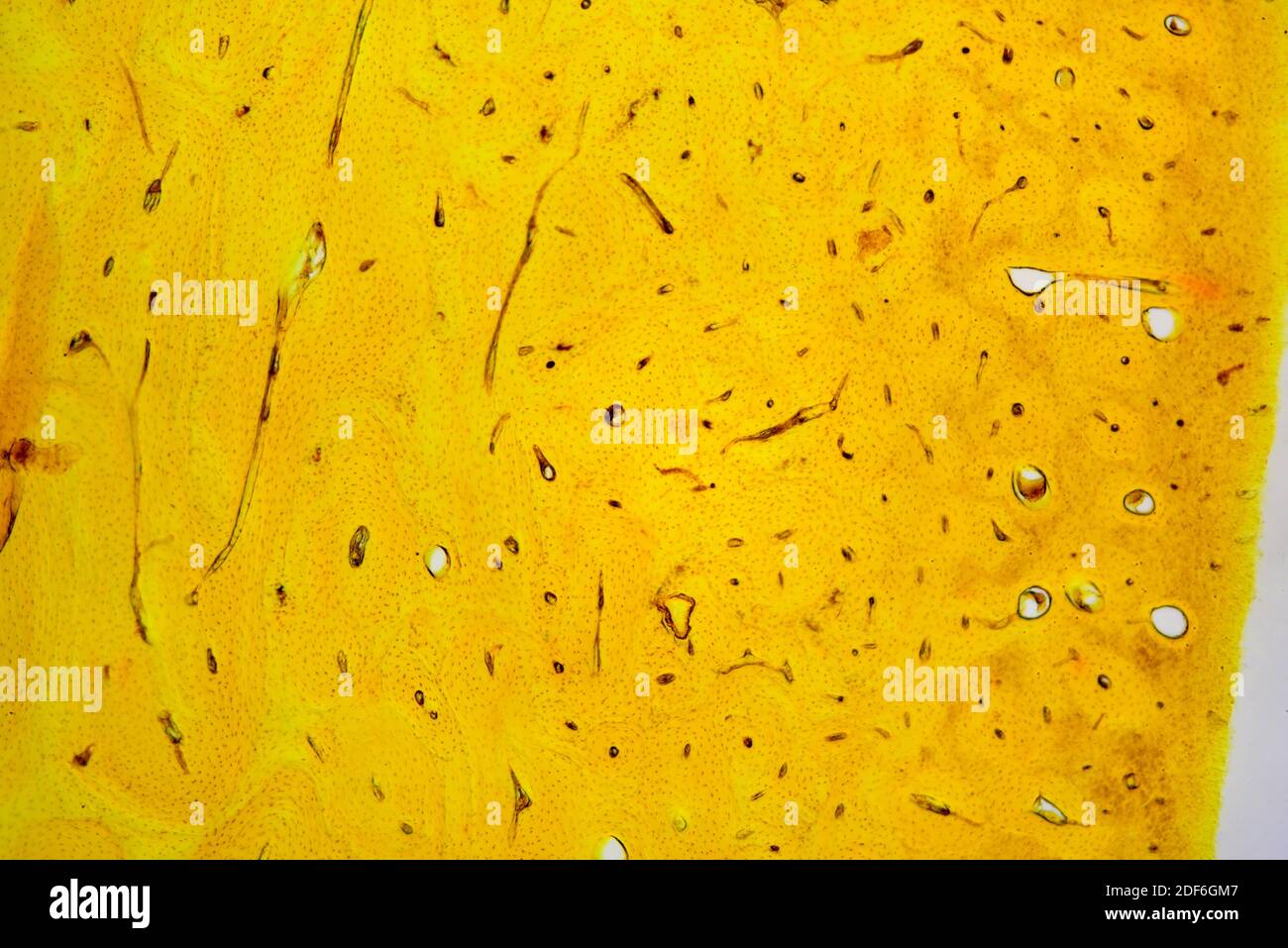 Osseous micrograph hi-res stock photography and images - Alamy