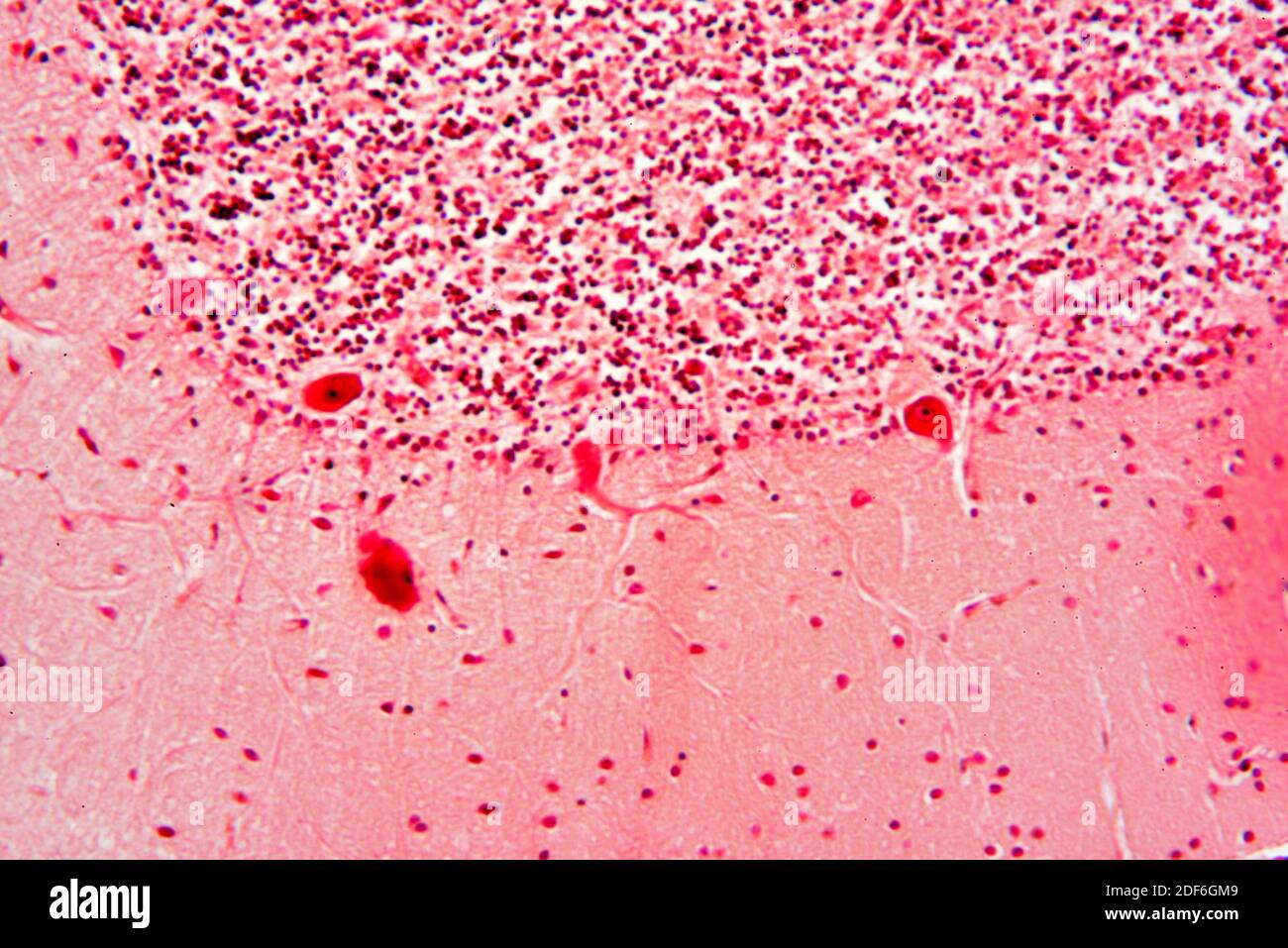 Human neuron micrograph hi-res stock photography and images - Alamy