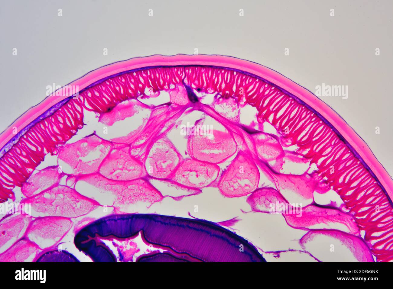 Ascaris Dissection Cuticle