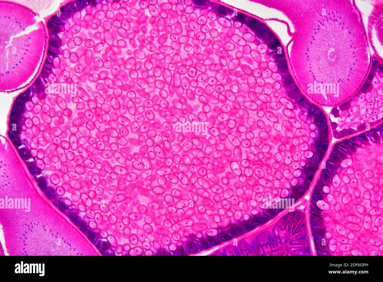 Uterus cross section hi-res stock photography and images - Alamy