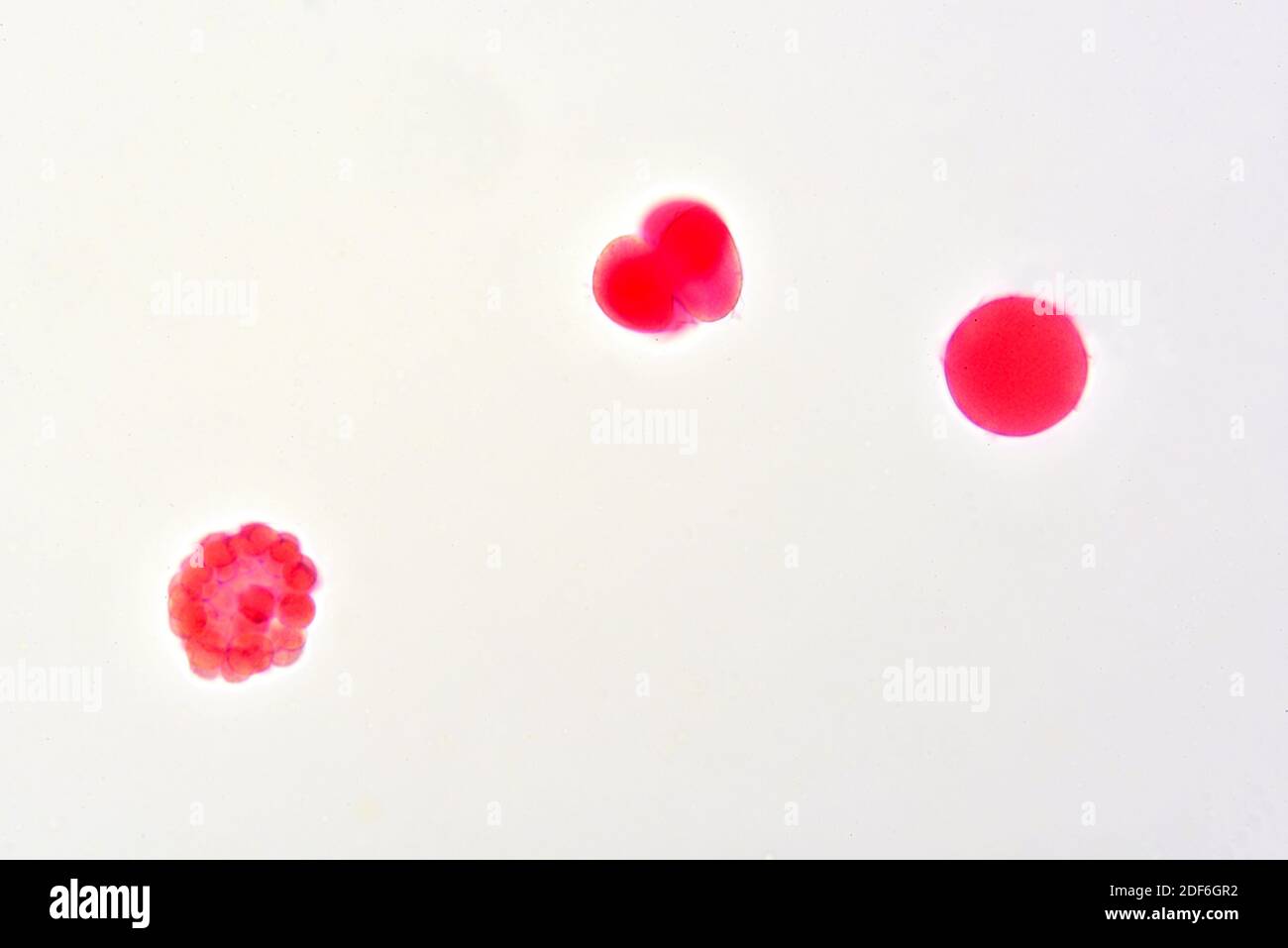 Morula photomicrograph hi-res stock photography and images - Alamy