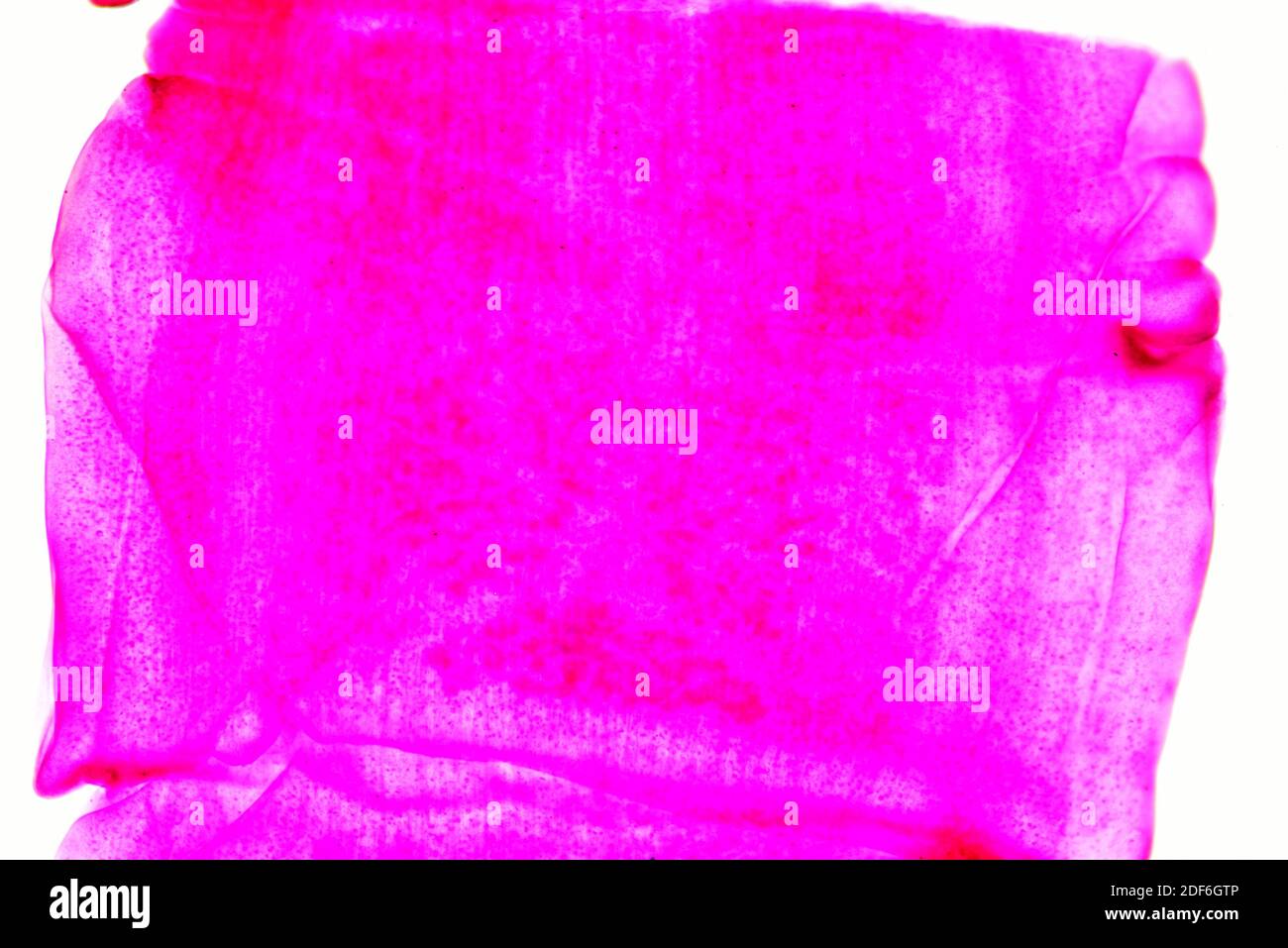 Proglottid hi-res stock photography and images - Alamy