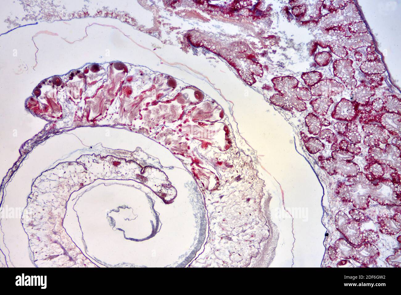 Ovotestis hi-res stock photography and images - Alamy