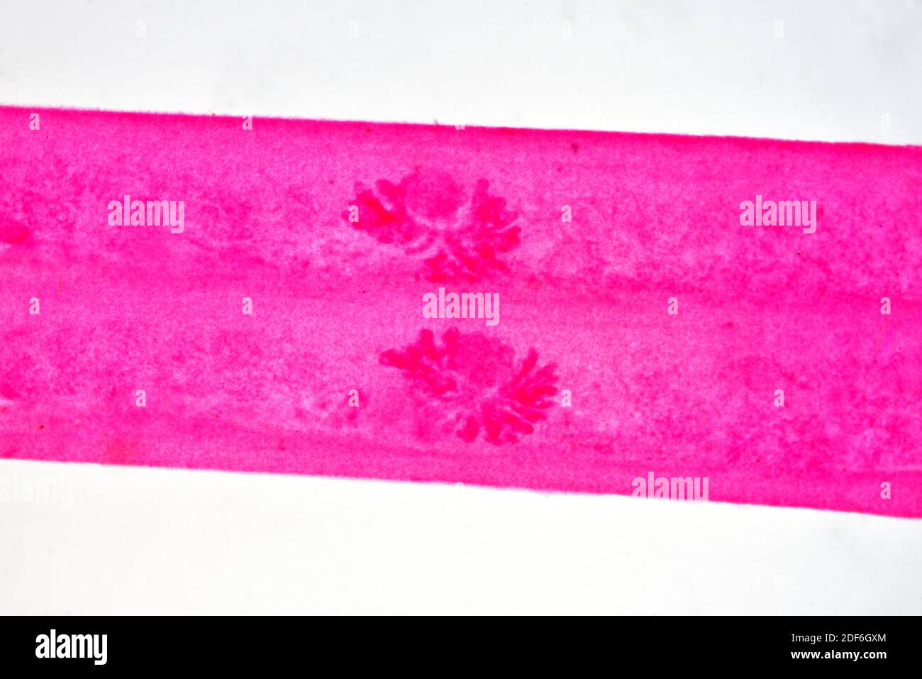 Tapeworm Proglottids Slide