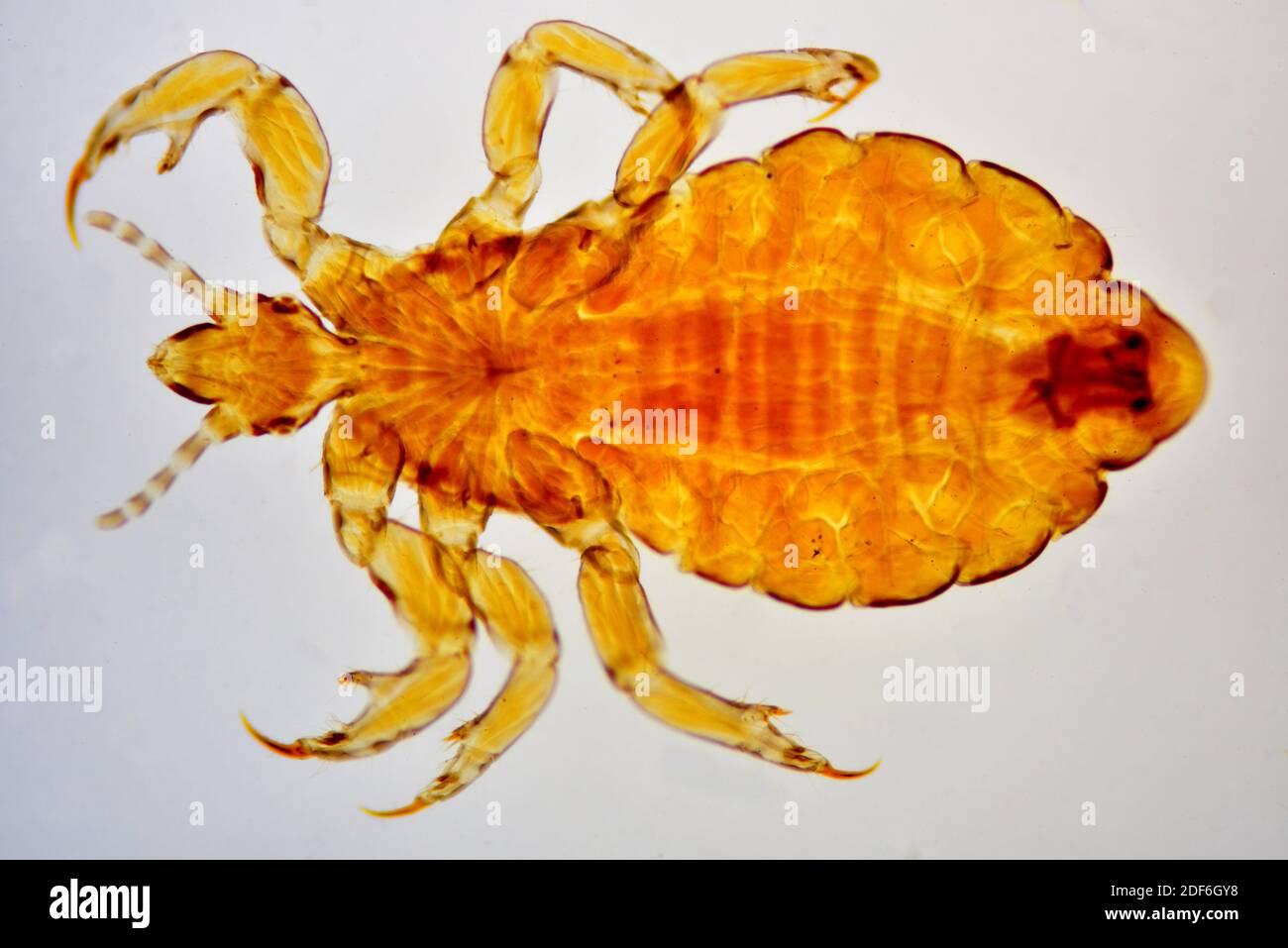 Pediculus humanus capitis hi-res stock photography and images - Alamy