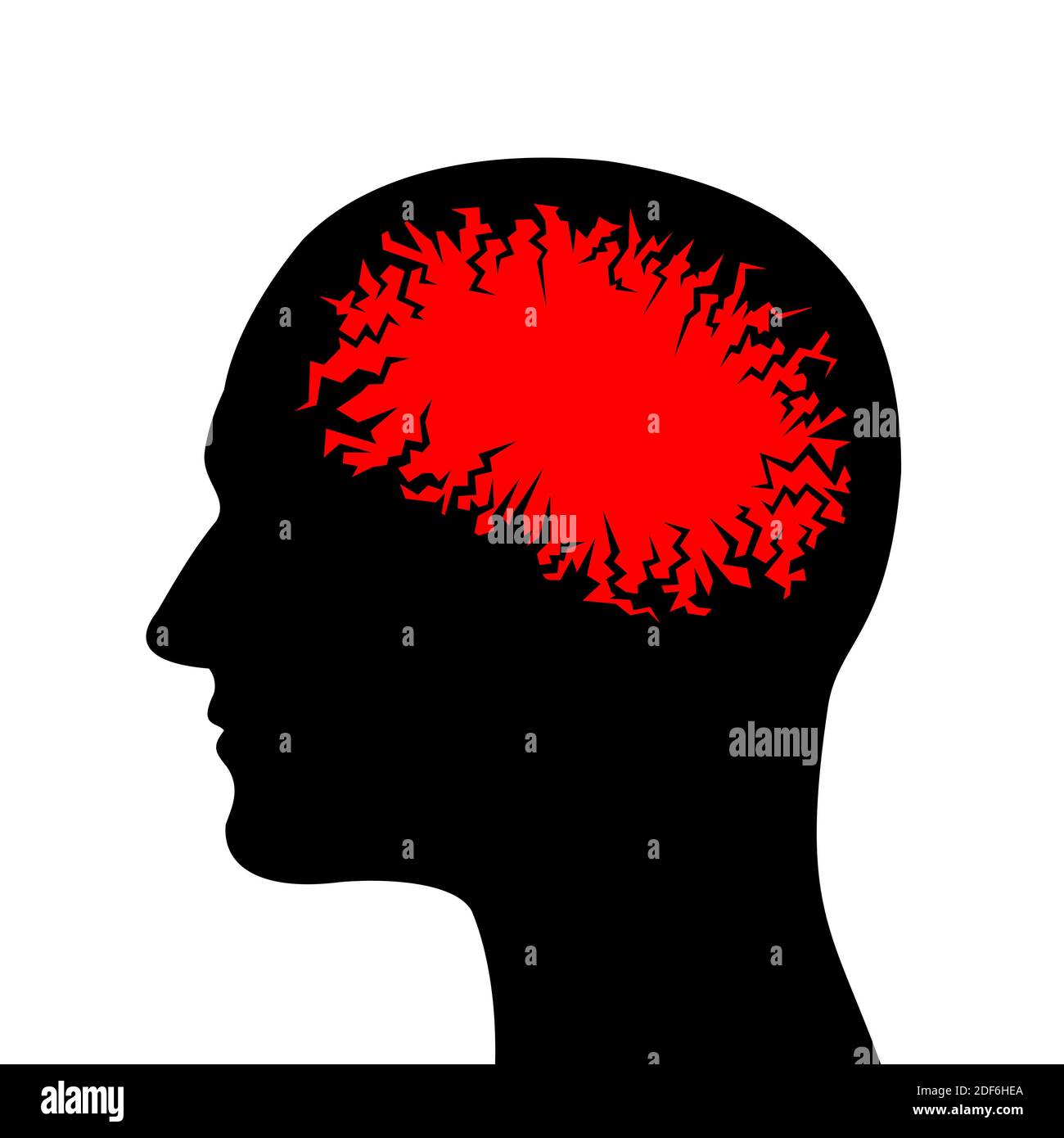 Brain in the danger. Negativity connected with brain - phobia as mental ...