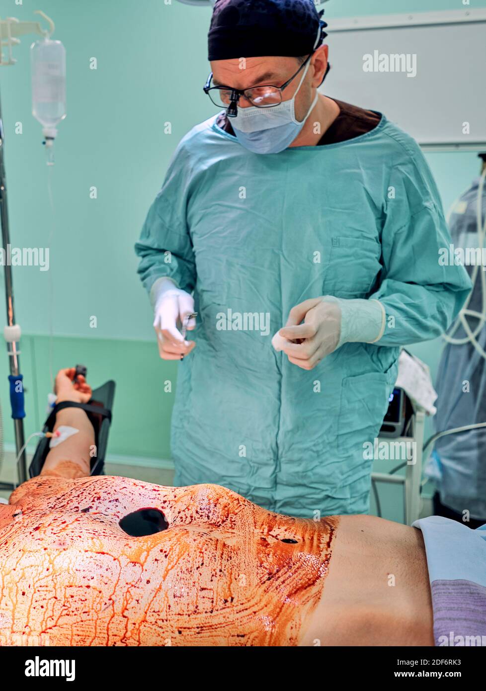 Surgeon Inserting Tube Into Patient During Surgery Stock Photo - Alamy