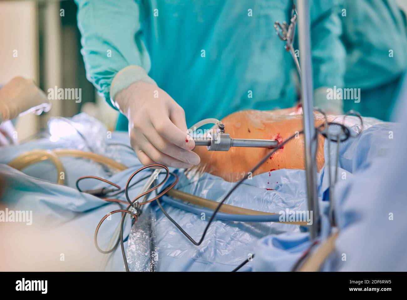 Surgeon Inserting Tube Into Patient During Surgery Stock Photo - Alamy