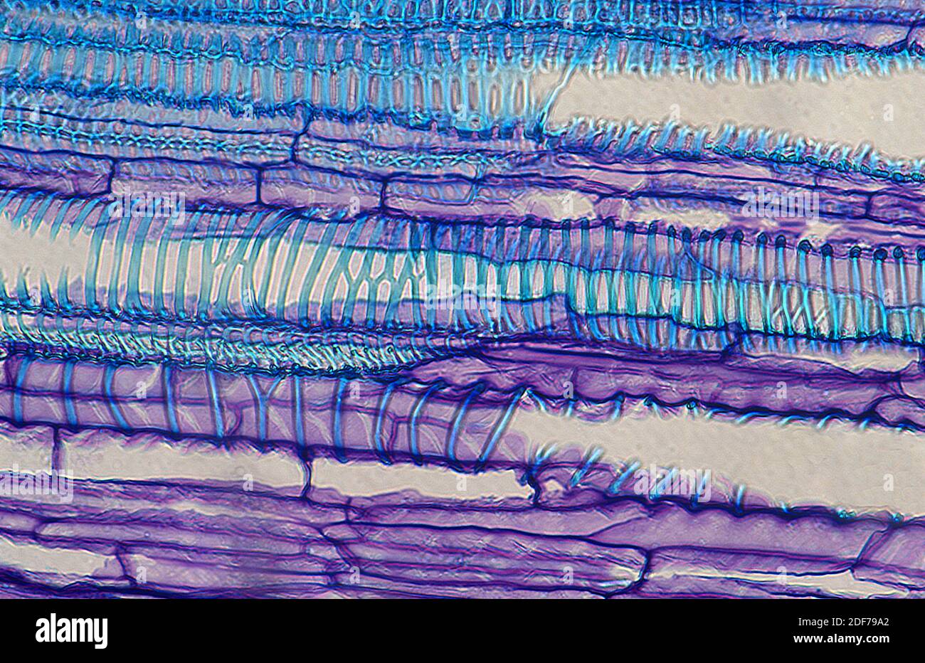 Xylem Longitudinal Section