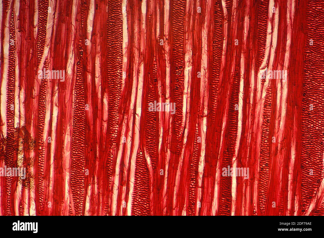 Tracheids Xylem