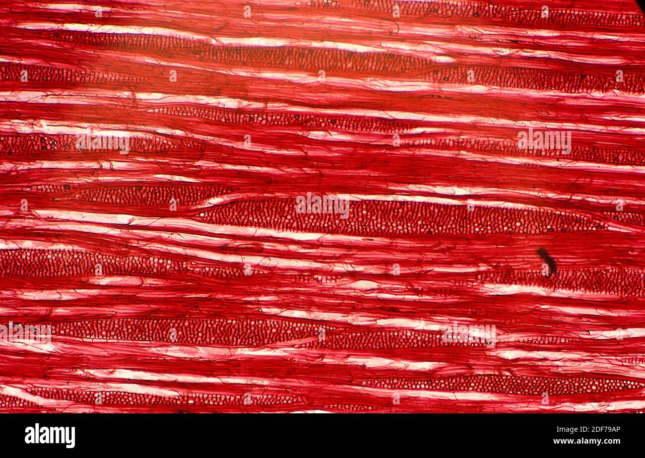Xylem vessel hi-res stock photography and images - Alamy
