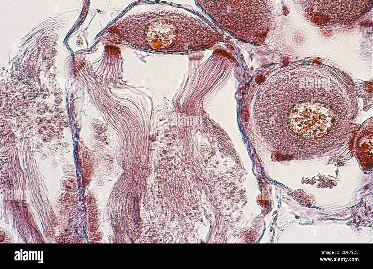 Ovotestis hi-res stock photography and images - Alamy