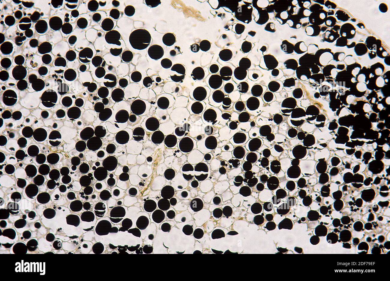 Adipose tissue hi-res stock photography and images - Alamy