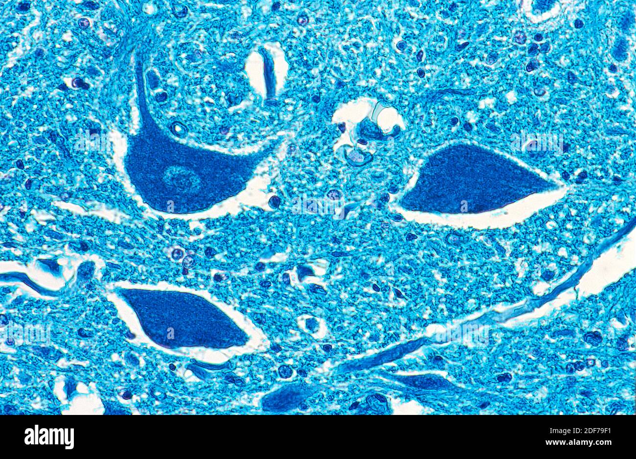 Motor neuron cross section hi-res stock photography and images - Alamy
