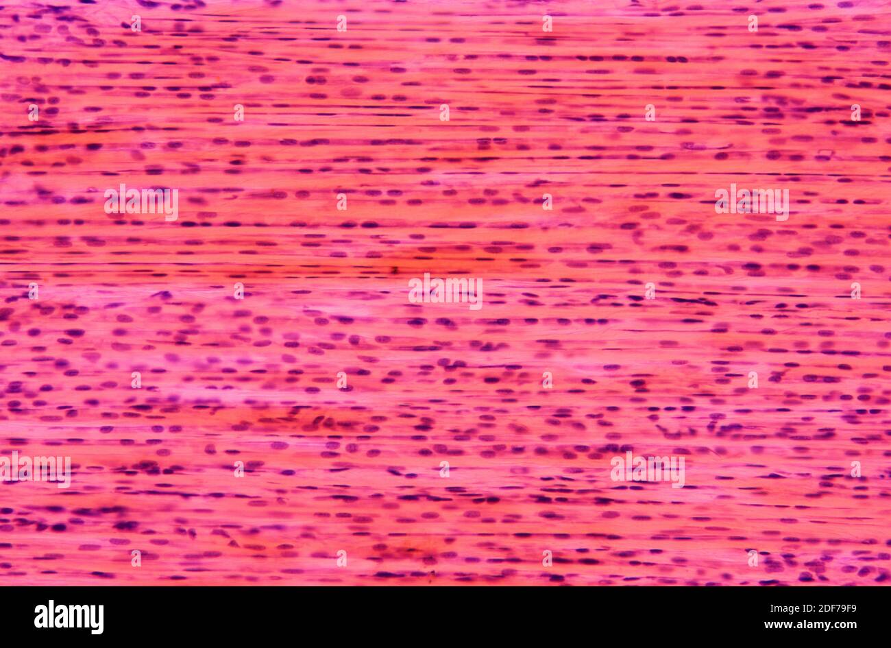 Dense Connective Tissue Slide