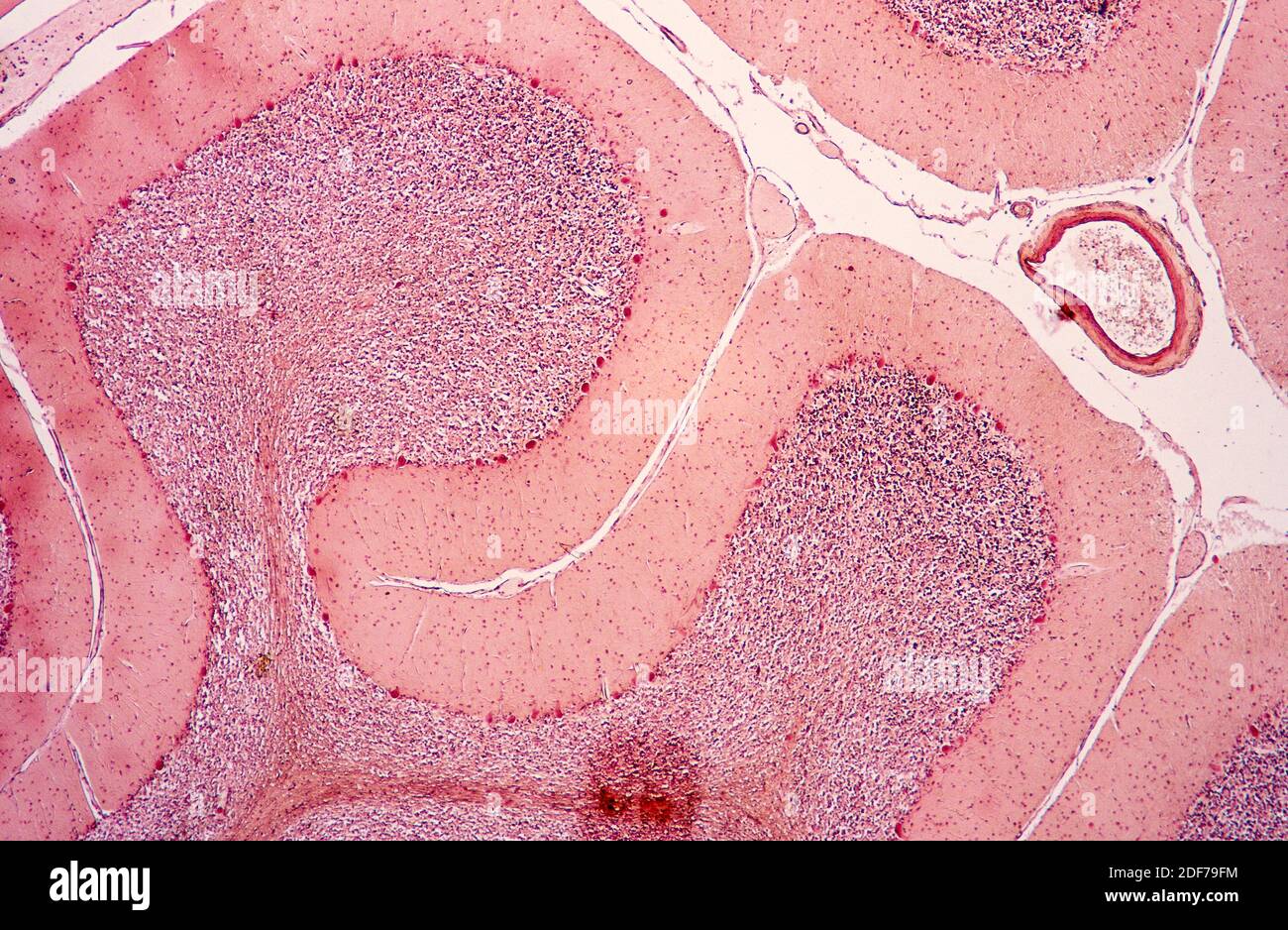 Purkinje Cells Histology