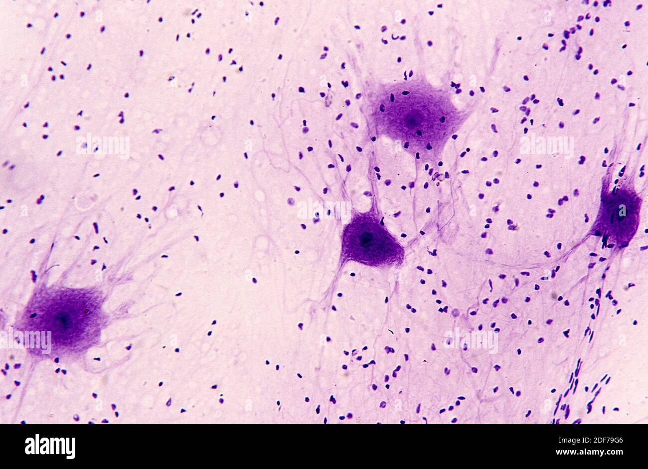 Photomicrograph neuron hi-res stock photography and images - Alamy