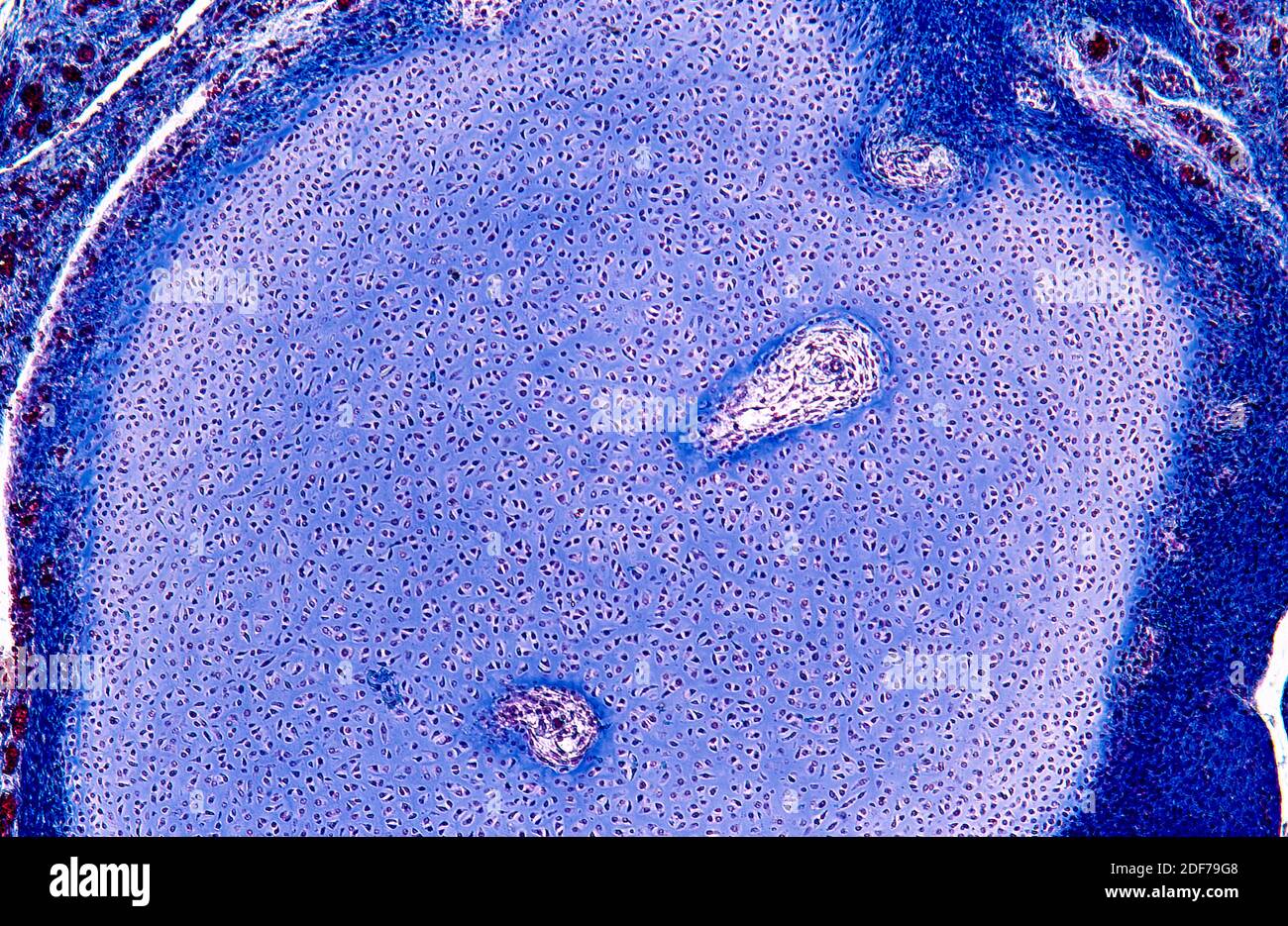 Ossification process hi-res stock photography and images - Alamy