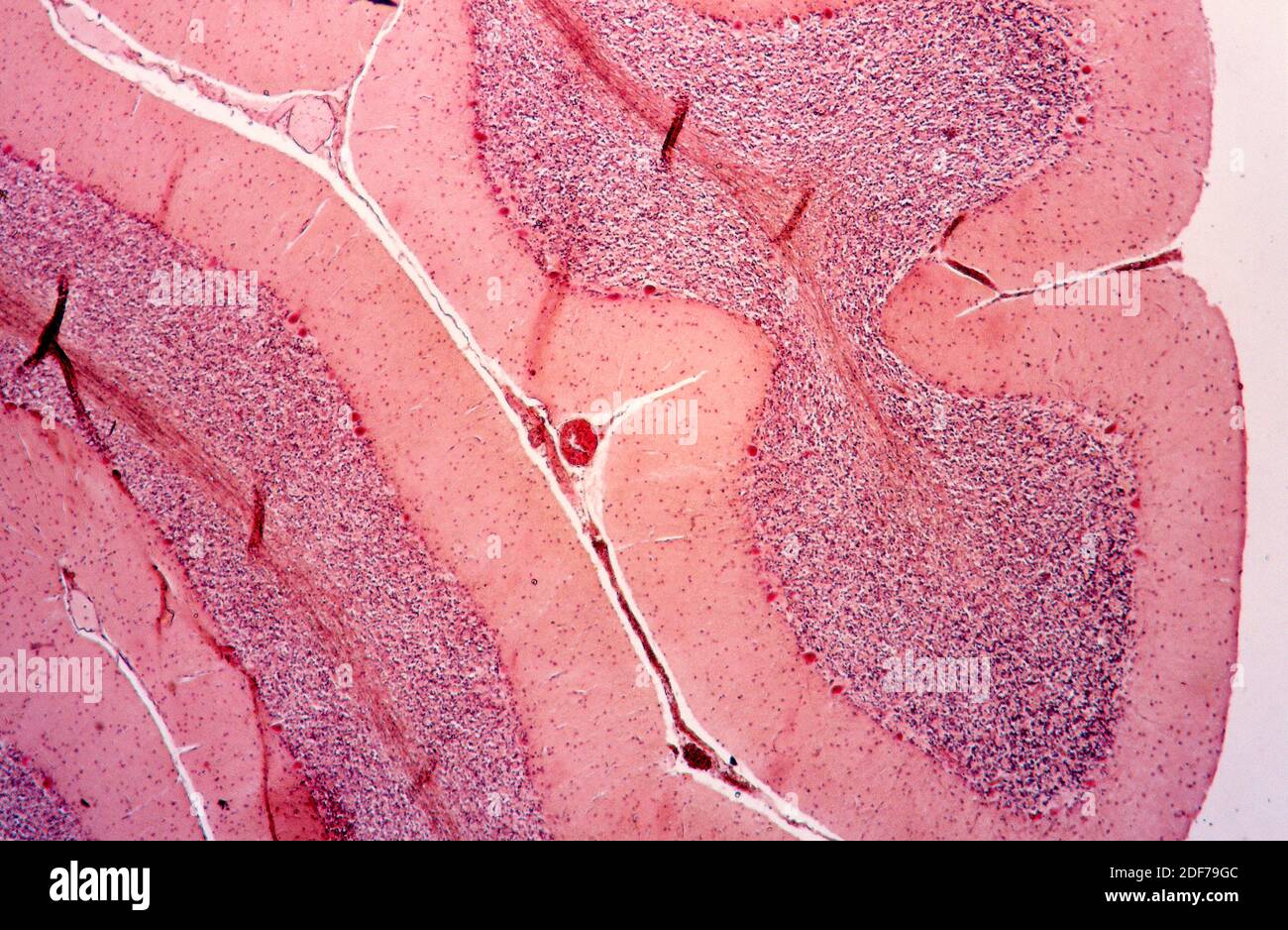 Cerebellum Tissue